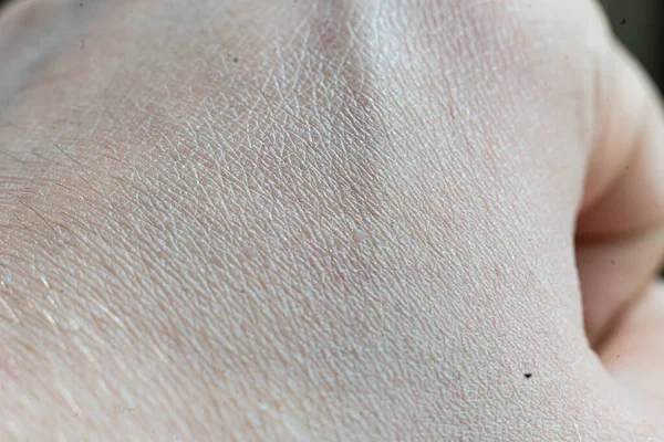 Ticks human skin Stock Photos, Royalty Free Ticks human skin Images ...