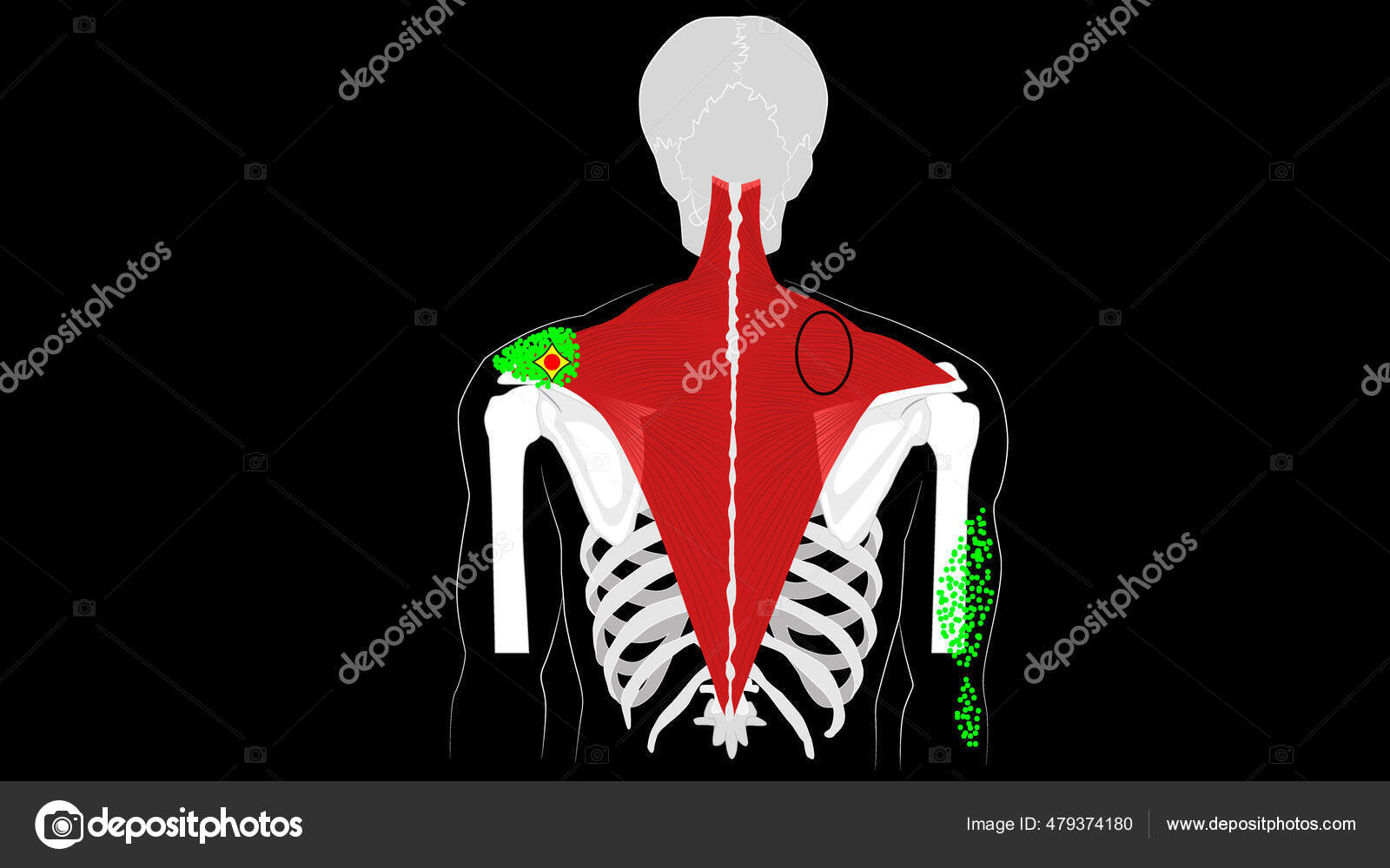 Trigger points and reflected pain in the trapezius. Stock Illustration ...