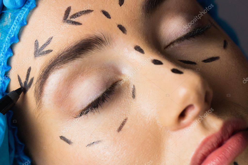 Patient with dotted lines on face — Stock Photo © Wavebreakmedia #112934362