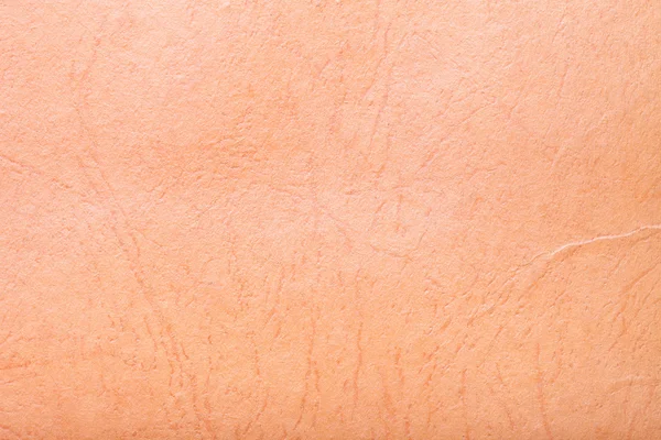 Sunburn peeling Stock Photos, Royalty Free Sunburn peeling Images ...