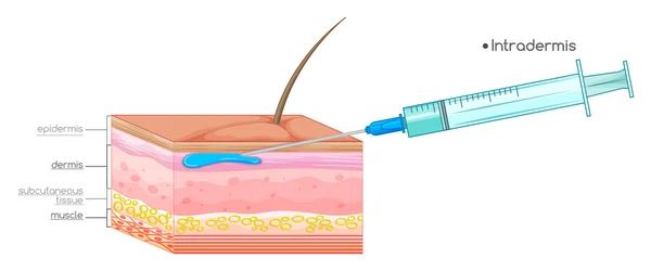 Set Type Injections Illustration Stock Vector Image by ©interactimages ...