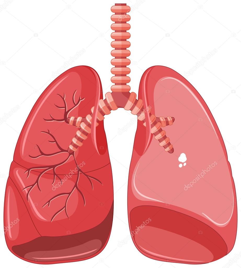 Human Lungs With Tuberculosis — Stock Vector © Interactimages 116839946
