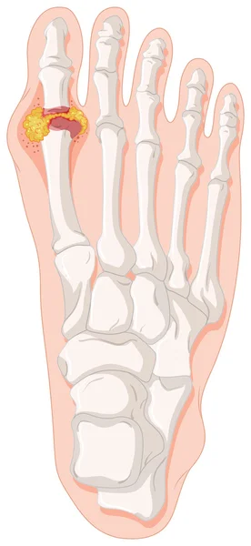 Foot diagram Vector Art Stock Images | Depositphotos