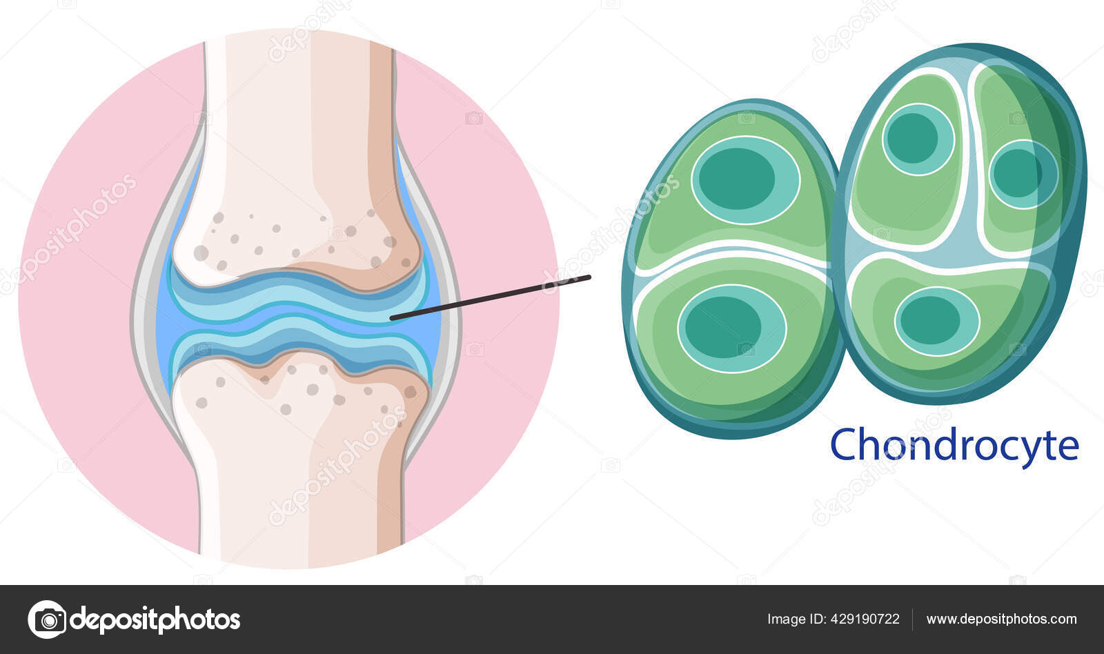 Cartel Informativo Ilustración Condrocitaria Stock Vector by ...