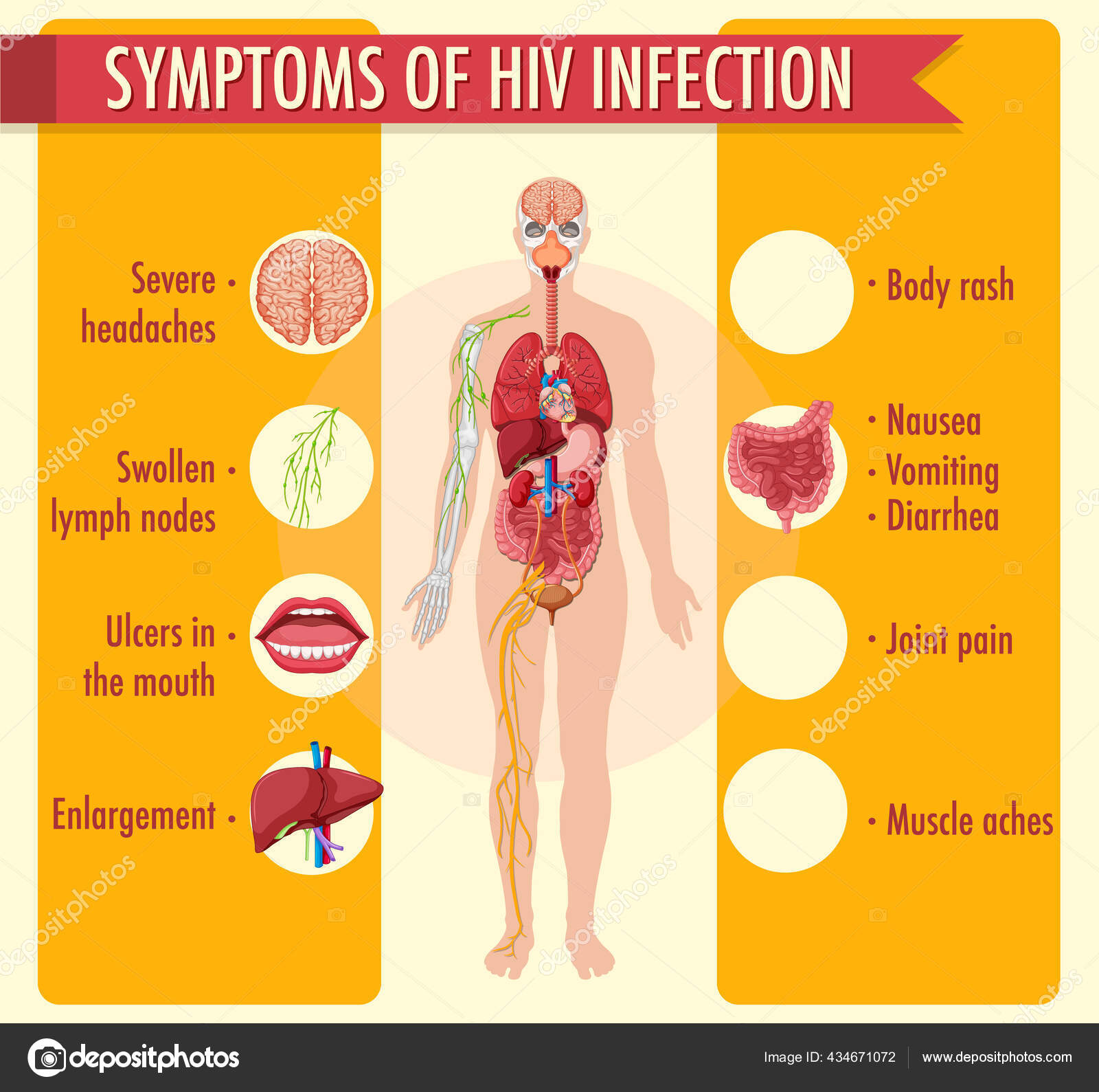 Symptoms Hiv Infection Infographic Illustration Stock Vector by ...