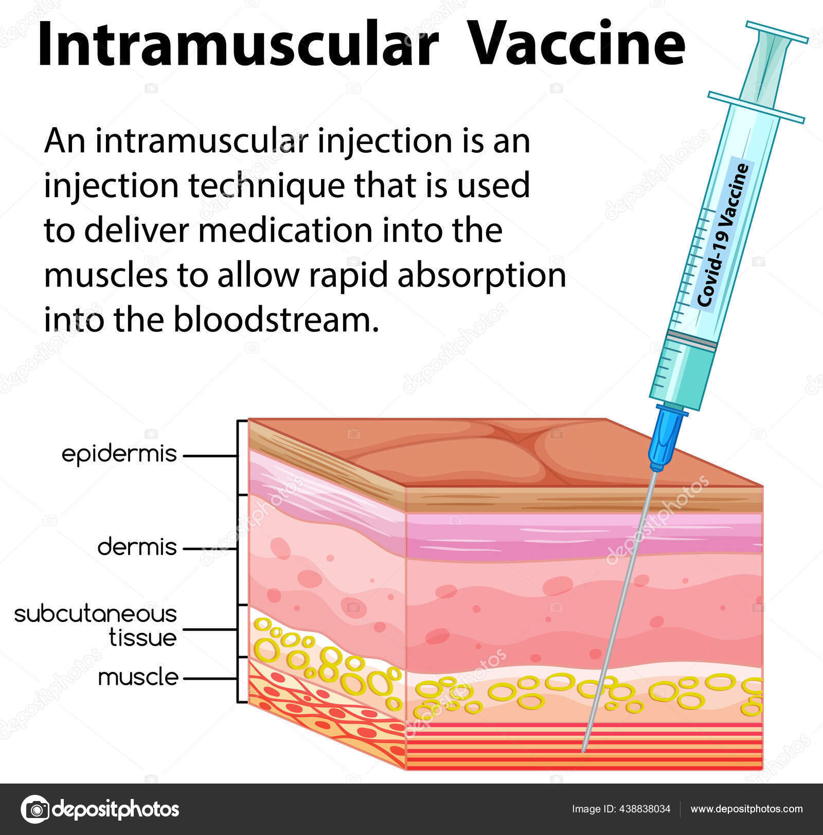 Information Vector Intramuscular Injection Illustration Stock Vector by ...