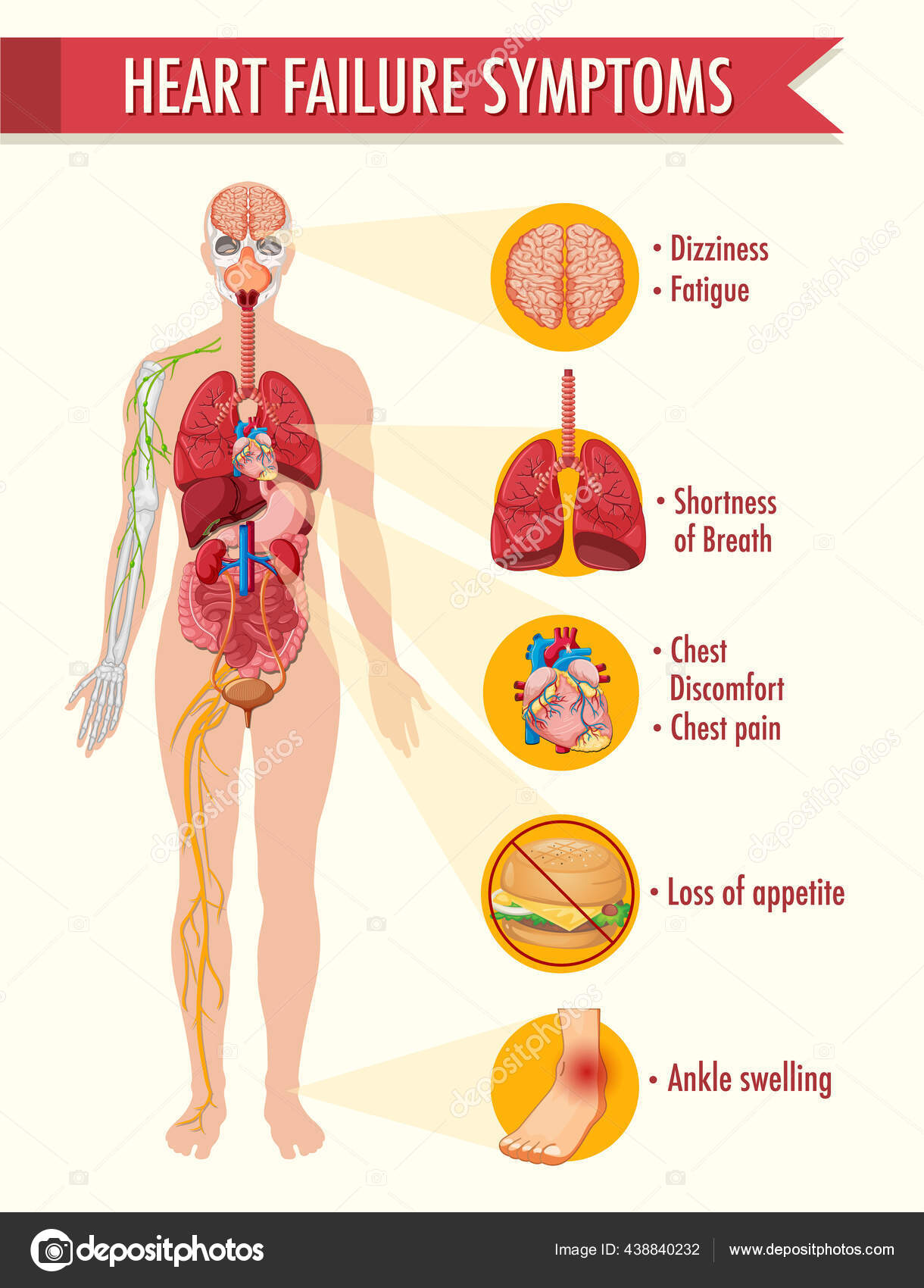 Symptomen Van Hartfalen Informatie Infographic Illustratie ...