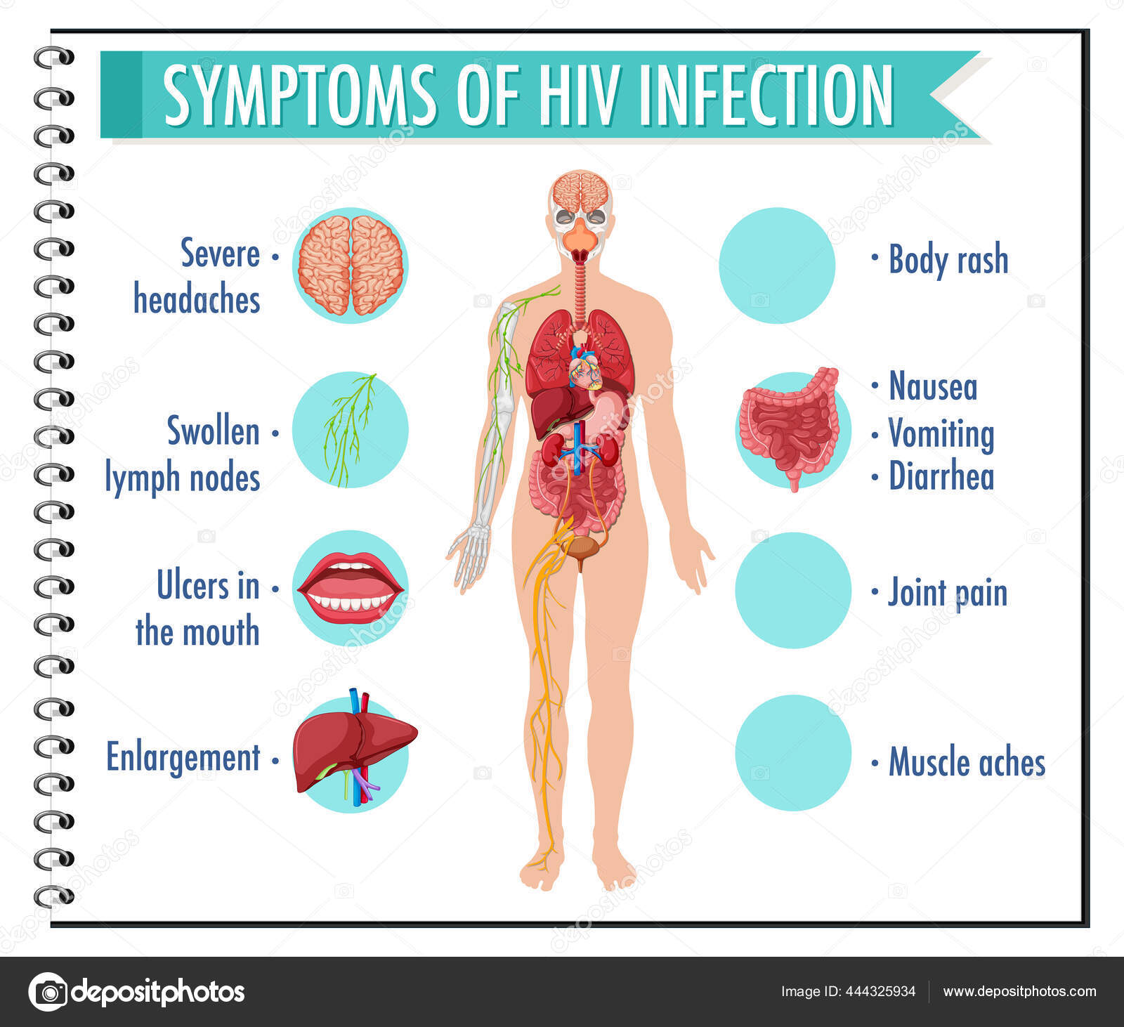 Symptômes L'infection Par Vih Illustration Infographique Vecteur par ...