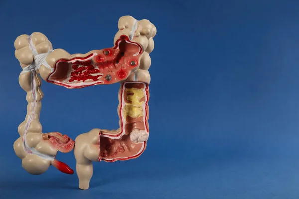 Colon test Stock Photos, Royalty Free Colon test Images | Depositphotos