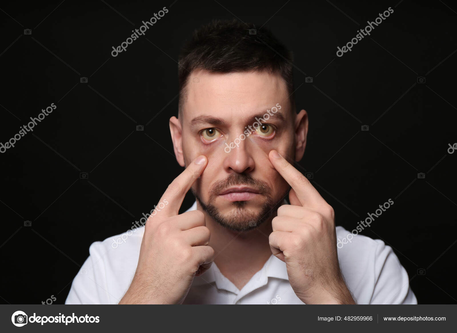 Man Checking His Health Condition Black Background Yellow Eyes Symptom ...