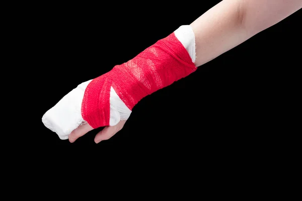 Imágenes de Fractura del brazo, fotos de Fractura del brazo sin ...