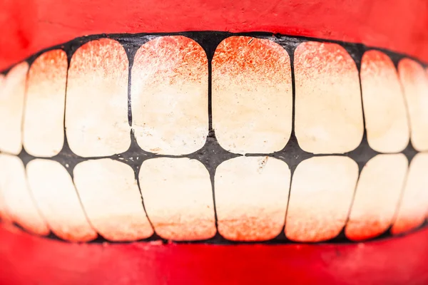 Orthodontic relapse Stock Photos, Royalty Free Orthodontic relapse ...