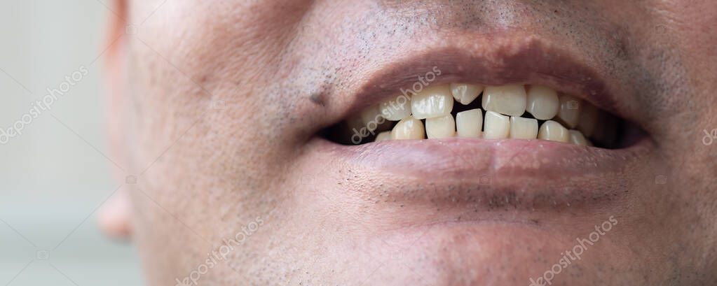 A man with no teeth Stock Photos, Royalty Free A man with no teeth ...