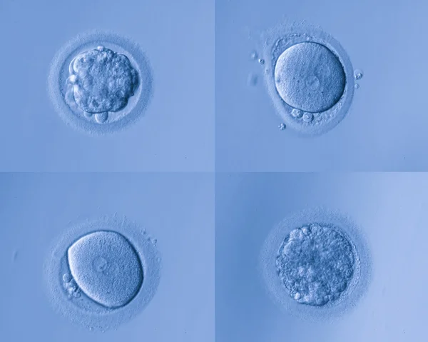 Human cells egg Stock Photo by ©red_hayabusa 84149326