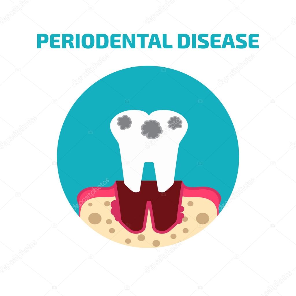 Periodontal disease icon Stock Vector Image by ©AnSim #92540856