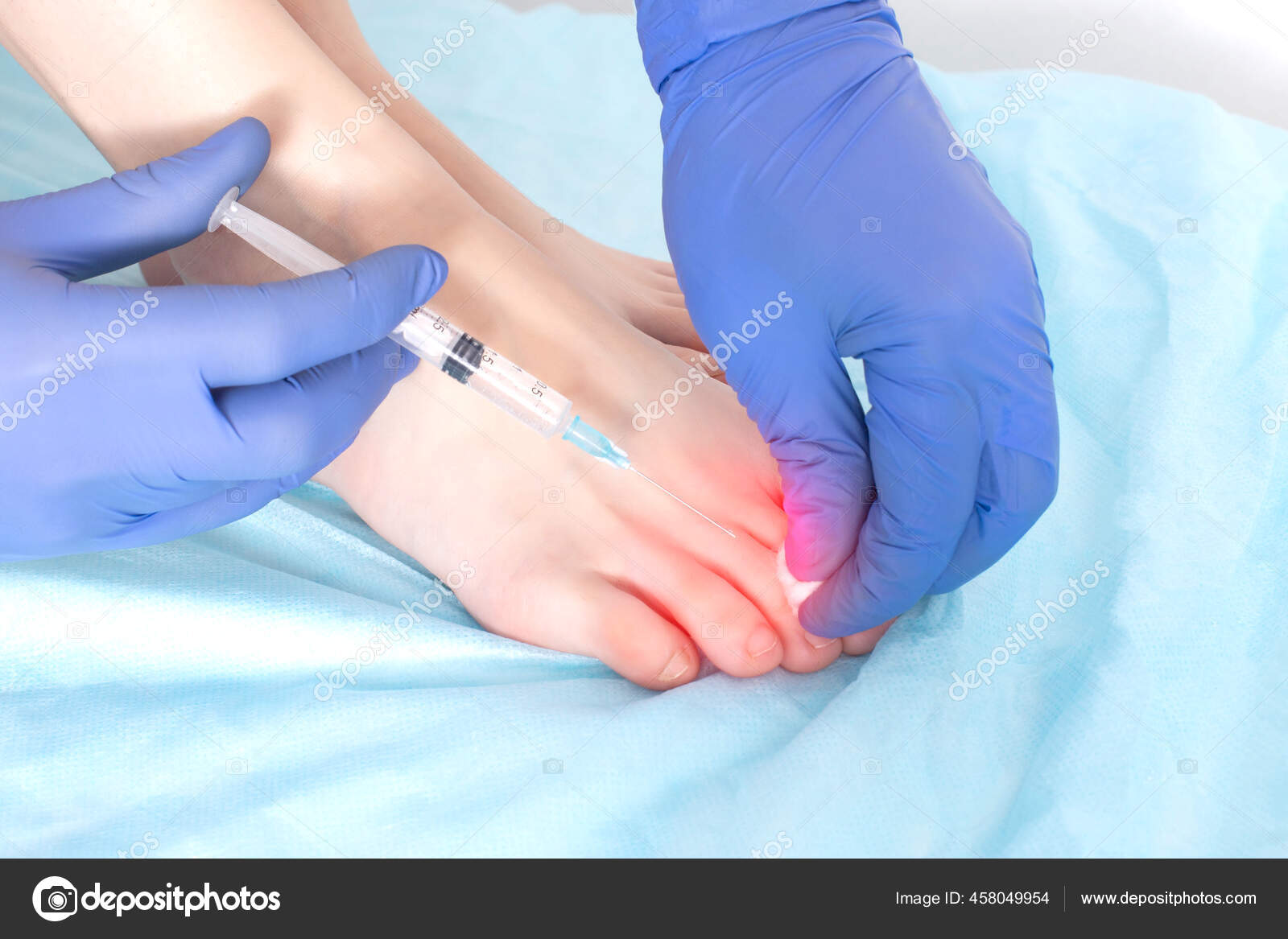 Doctor Makes Injection Joint Toe Arthritis Arthrosis Inflammation Joint ...
