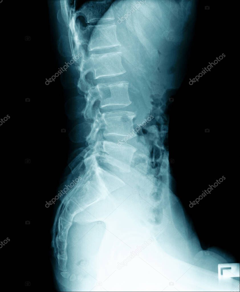 imagen de rayos X del abdomen humano, imagen de la columna vertebral ...