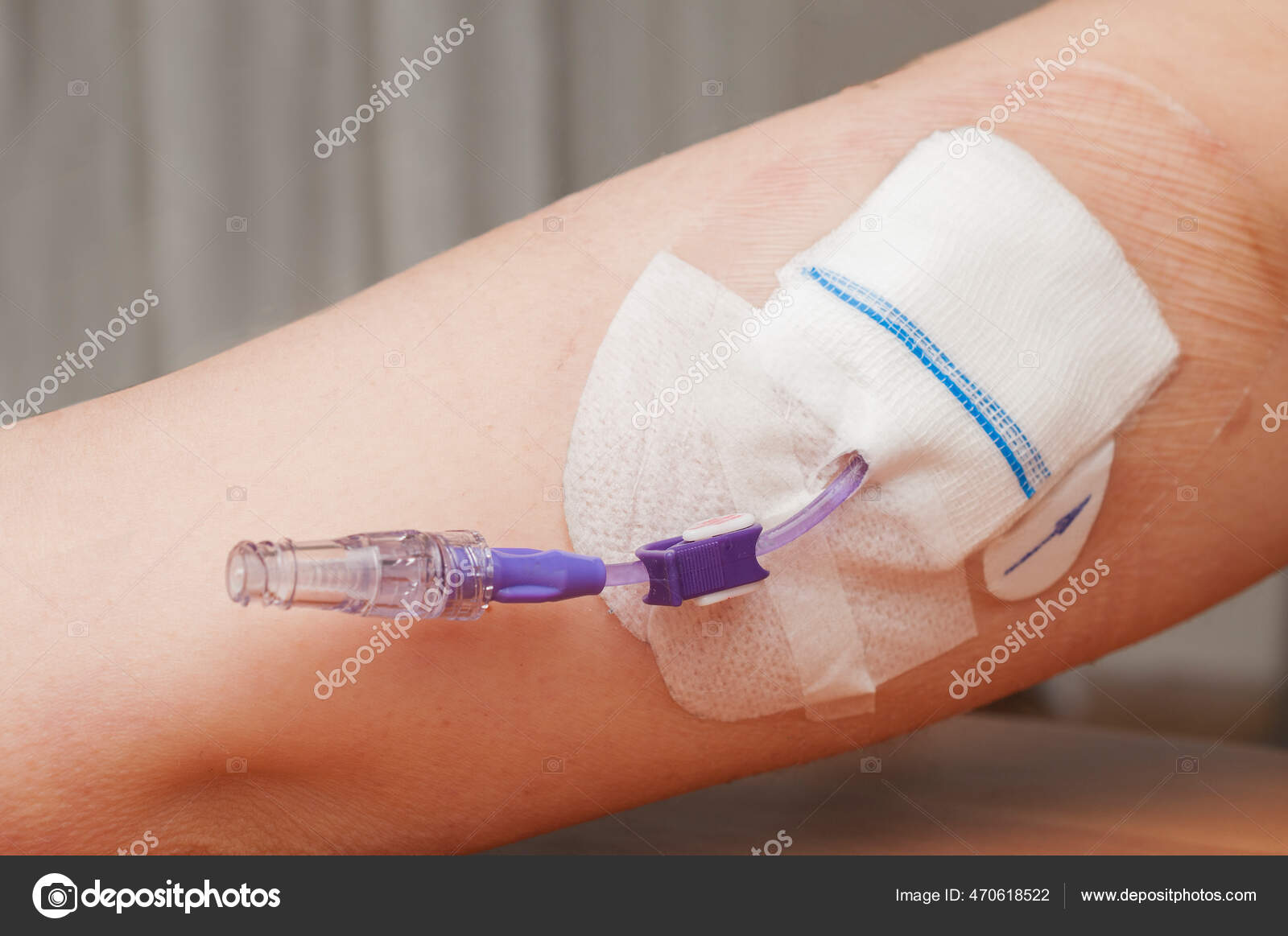 Picc Catéter Central Insertado Periféricamente Brazo Una Mujer Joven Picc — Foto de stock ...