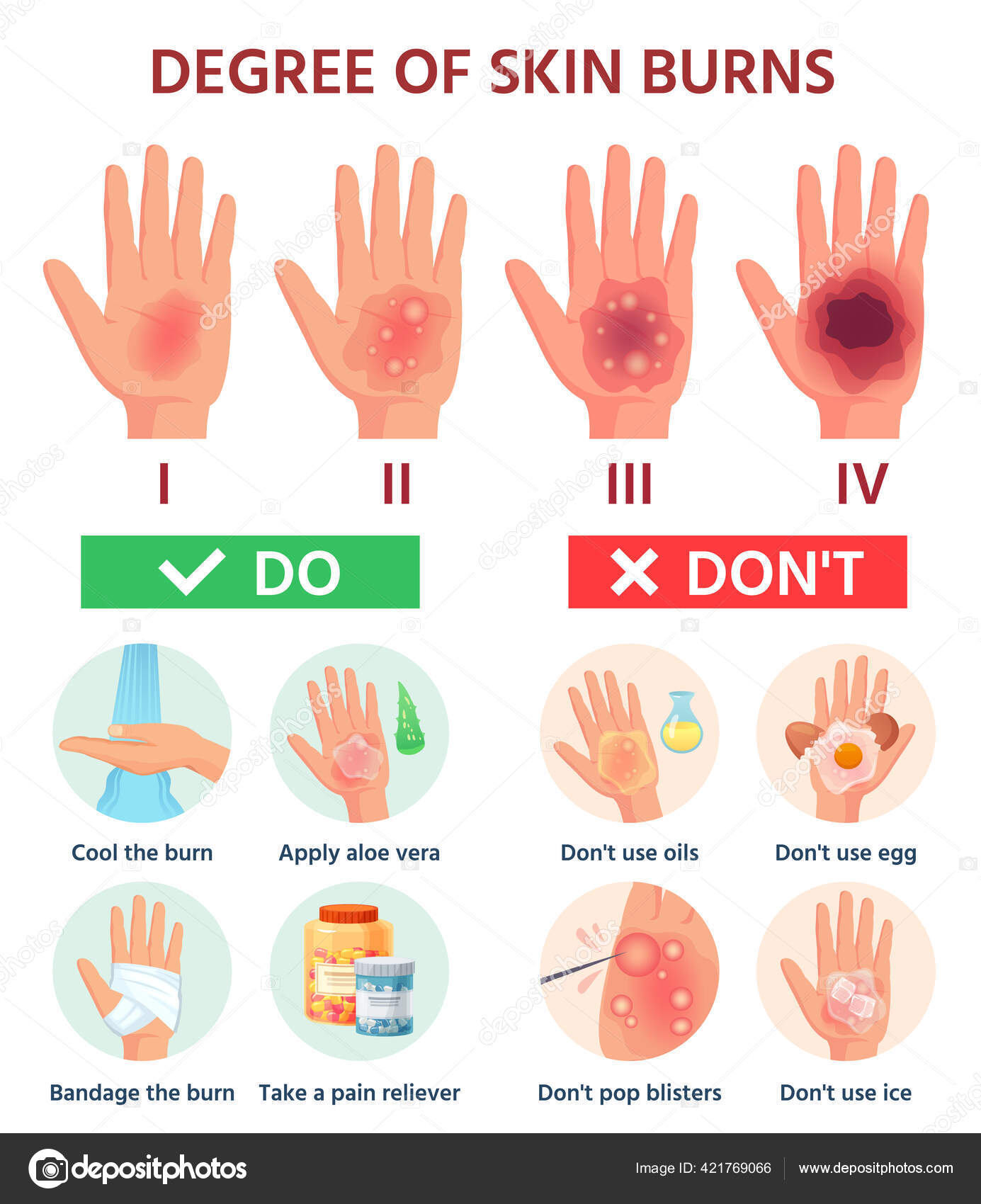 Burns degree. First aid for burn wound. Fire damage to skin ... Burns degree. First aid for burn wound. Fire damage to skin ...