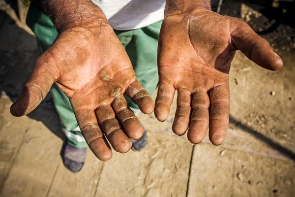 Injured open palms - Stock Image - Everypixel