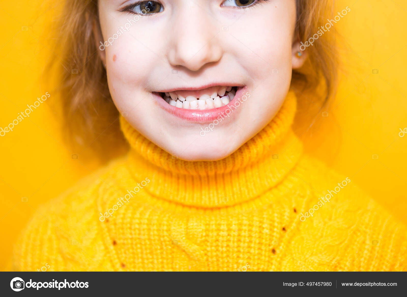 Girl Shows Her Teeth Pathological Bite Malocclusion Overbite Pediatric ...