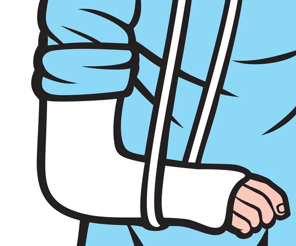 ᐈ Yeso en el brazo animado de stock, vectores brazo de yeso | descargar ...