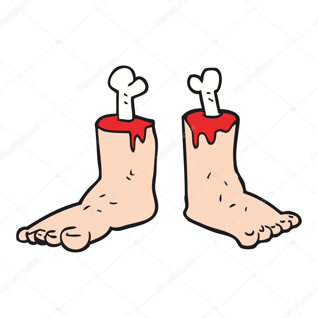 Ankle Sprain Cartoon