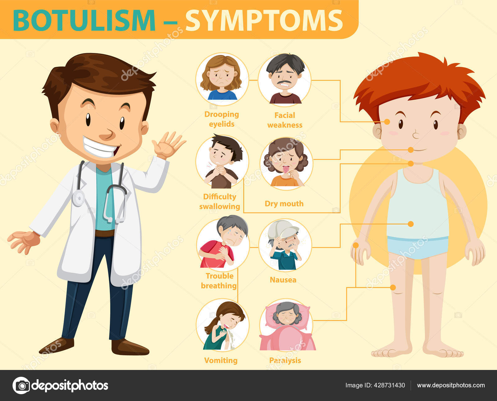 Ilustrasi Infografis Informasi Gejala Botulism Vektor Stok oleh ...