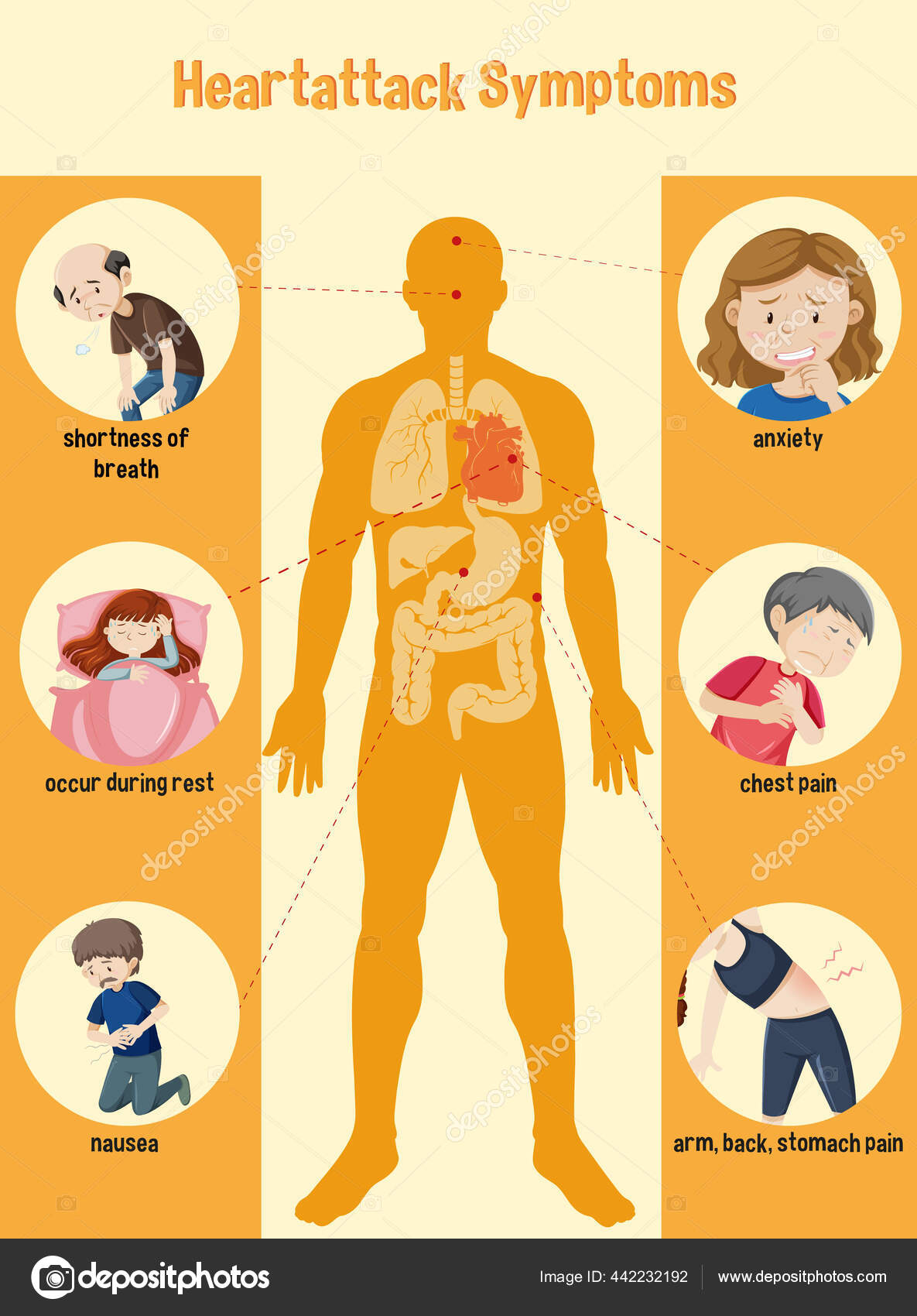 Ataque Cardíaco Síntomas Información Ilustración Infográfica vector ...