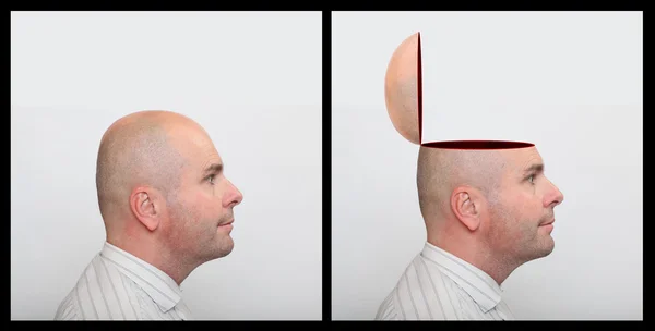 Hairless men's head with funnel Stock Photo by ©vladvitek 65960571