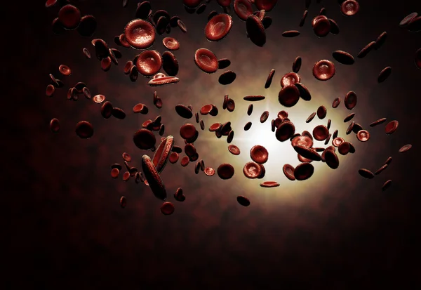 Sickle Cell Anemia Disease Scd Blood Cells Illustration — Stock Photo ...