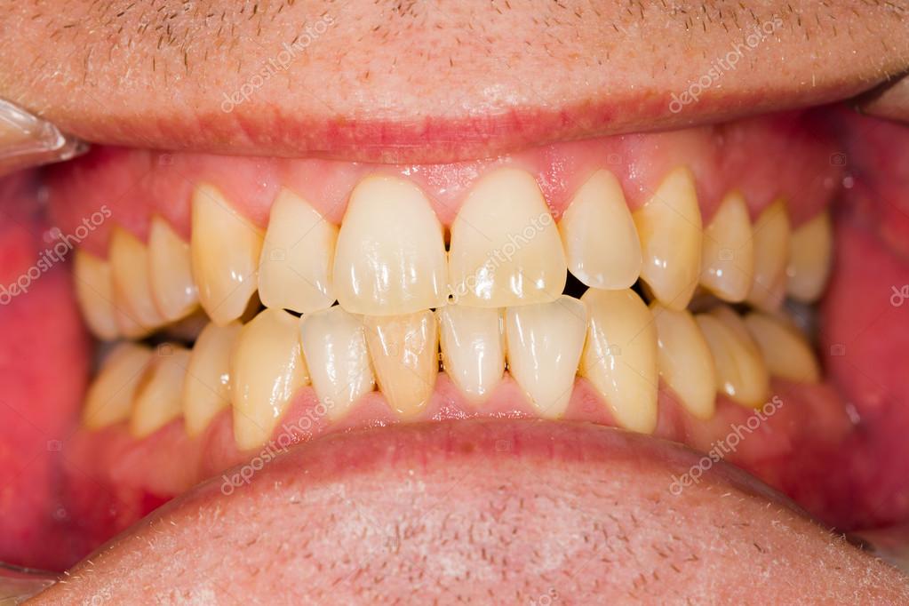 Healthy entire natural denture — Stock Photo © Lighthunter #76686809