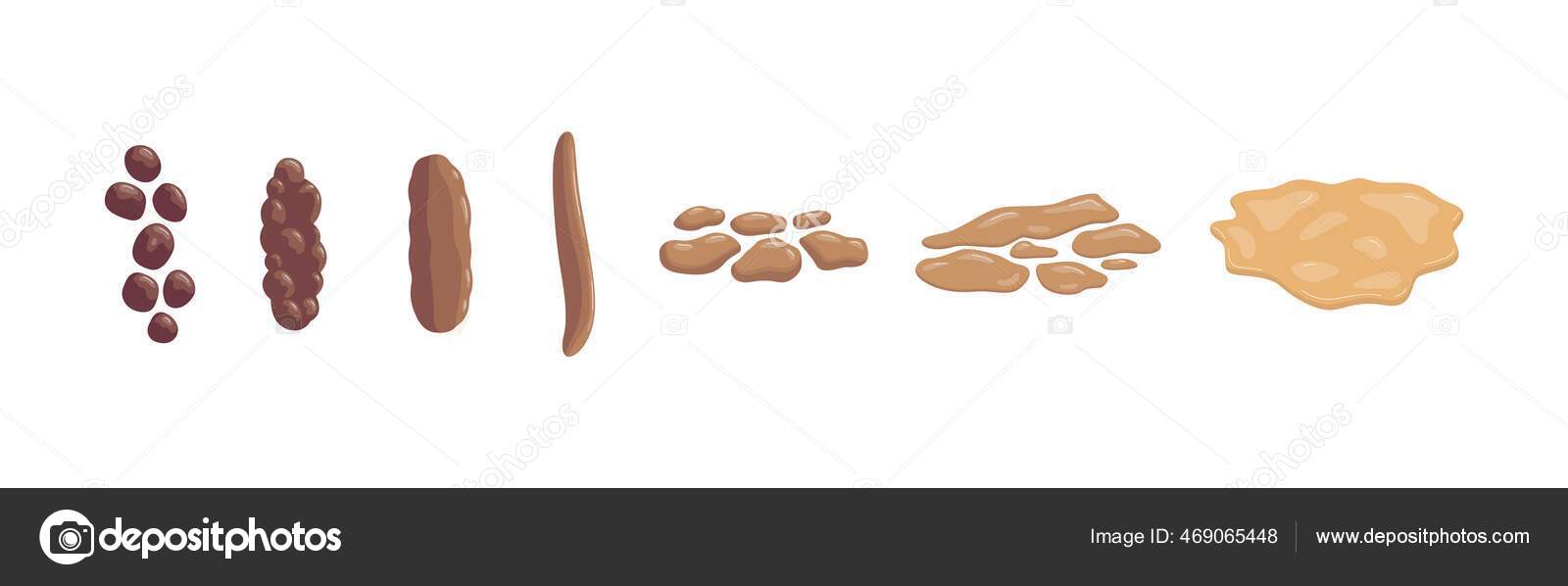 A set of various types human feces - constipation, normal and diarrhea ...