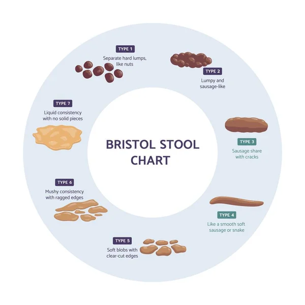 Stool chart Vector Art Stock Images | Depositphotos