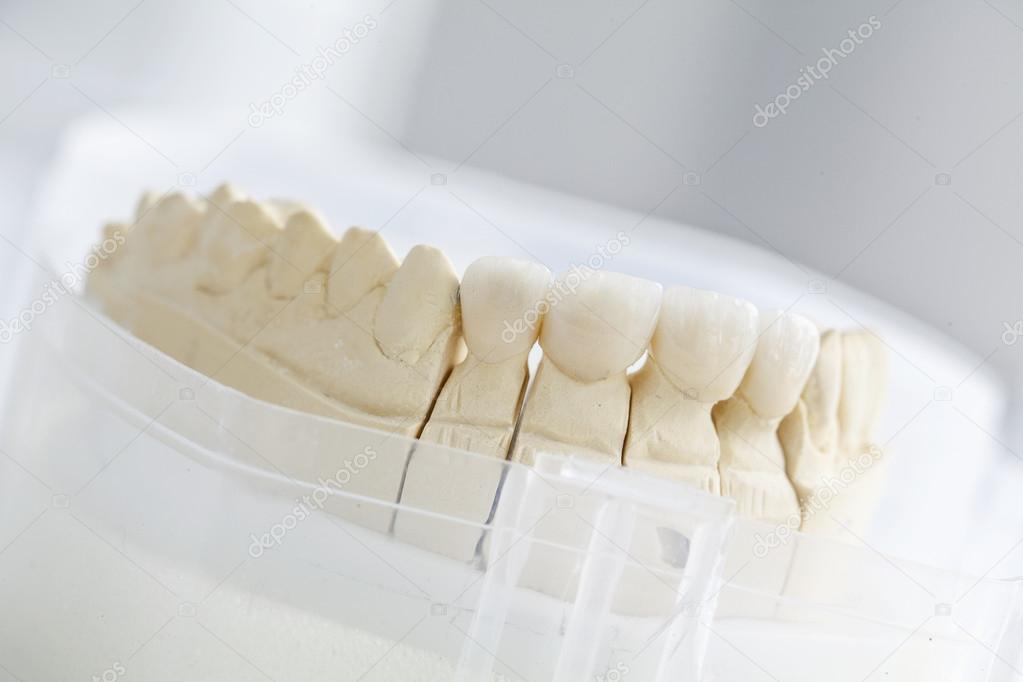 Ceramic bridge on plaster model Stock Photo by ©seb_ra 109733998