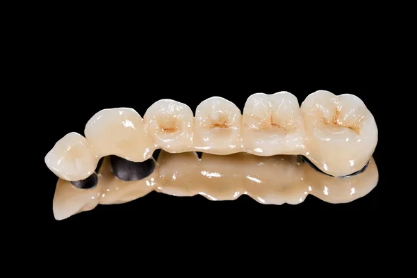 Dental ceramic bridge Stock Photo by ©obencem 52339891