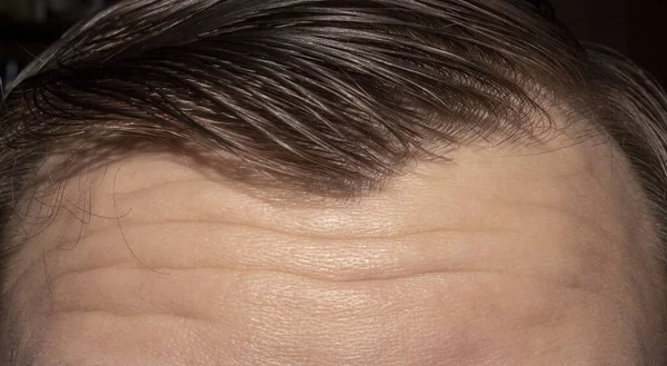 Man's Forehead Furrowed Wrinkles Forehead Background Photo Forehead ...