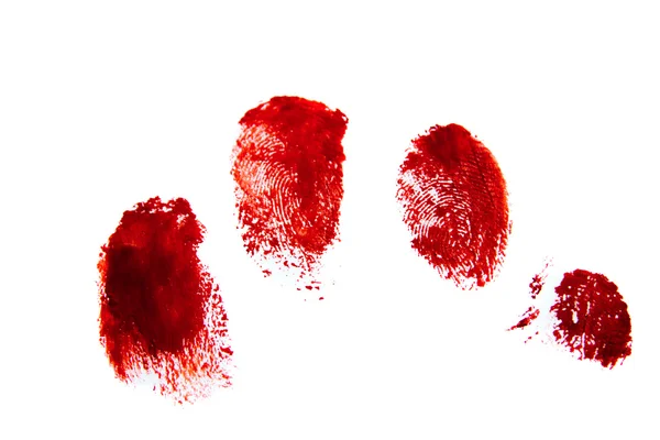 Bloody finger Stock Photos, Royalty Free Bloody finger Images ...
