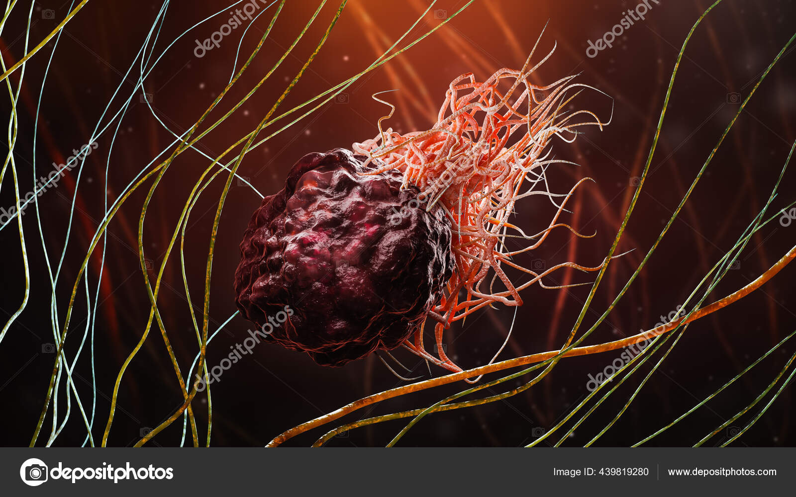 Cancer Tumor Cell Fibrous Tissue Close Rendering Illustration Carcinoma ...