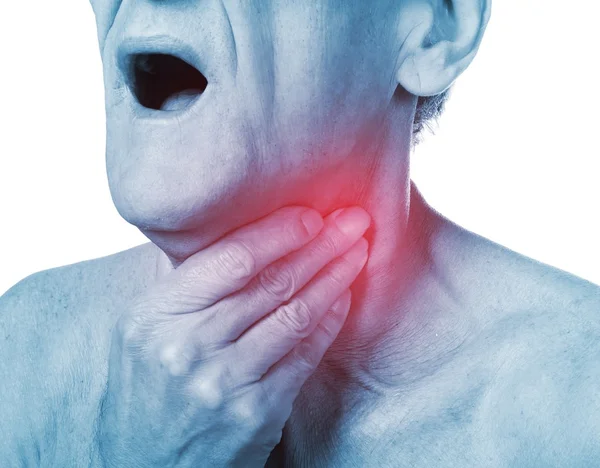 Keelkanker Stockfoto's, Rechtenvrije Keelkanker afbeeldingen ...