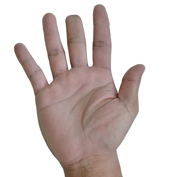 Injured hand Stock Photos, Royalty Free Injured hand Images | Depositphotos