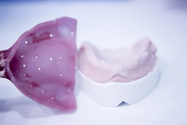 Dental impression molds Stock Photos, Royalty Free Dental impression ...