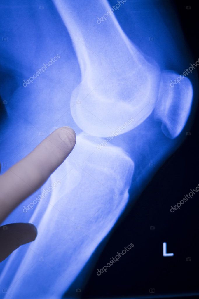 Exploración por rayos X de rodilla y cirujano — Foto de stock ...