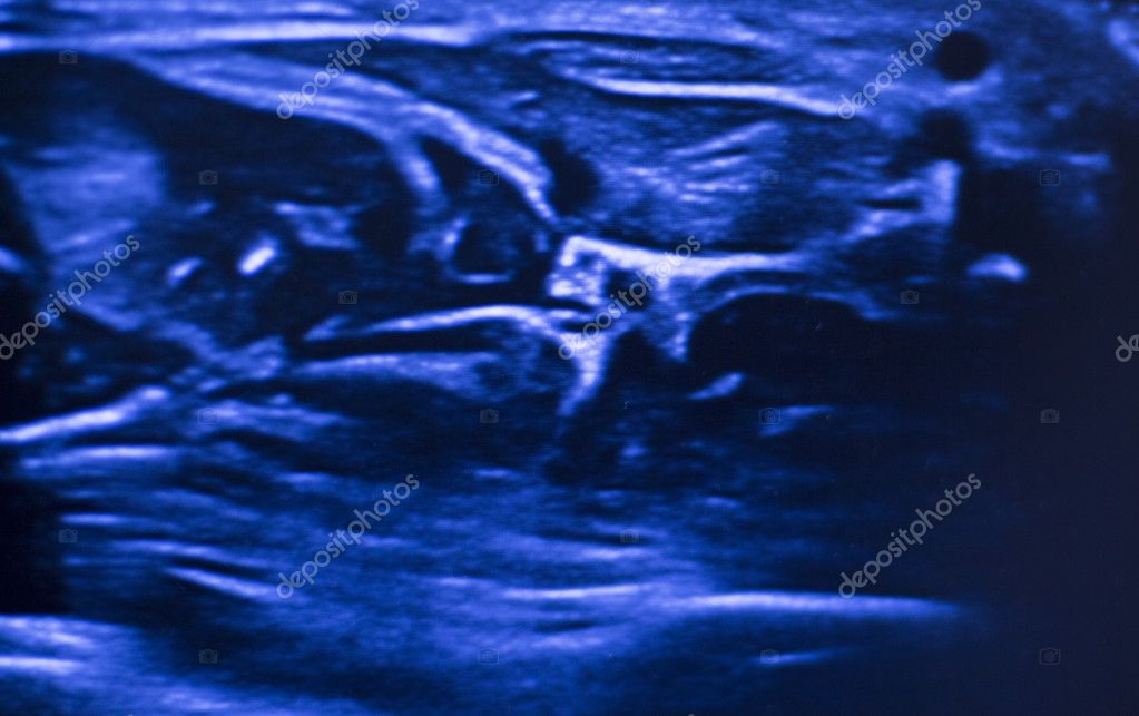 Ultrasound ecograph EPI ecography — Stock Photo © edwardolive #117386634