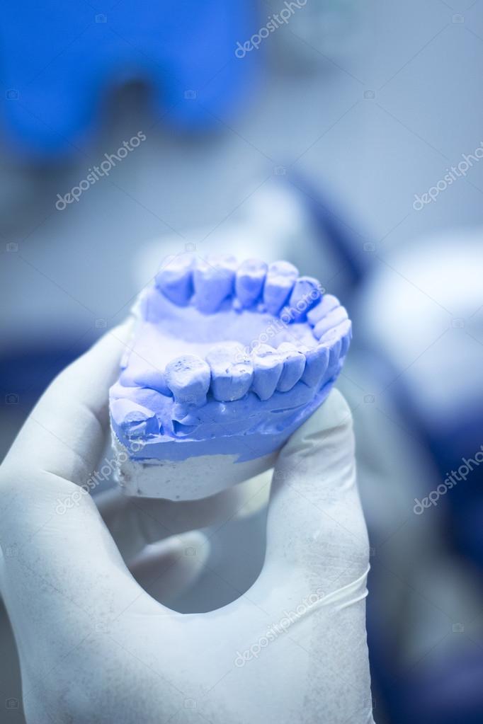 Dental mold dentist clay teeth ceramic plate model cast — Stock Photo ...