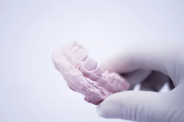 Dental mold dentists clay teeth ceramic plate cast — Stock Photo ...