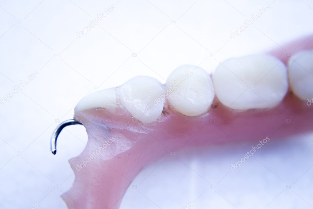 Prosthetic dental partial dentures — Stock Photo © edwardolive #94488656