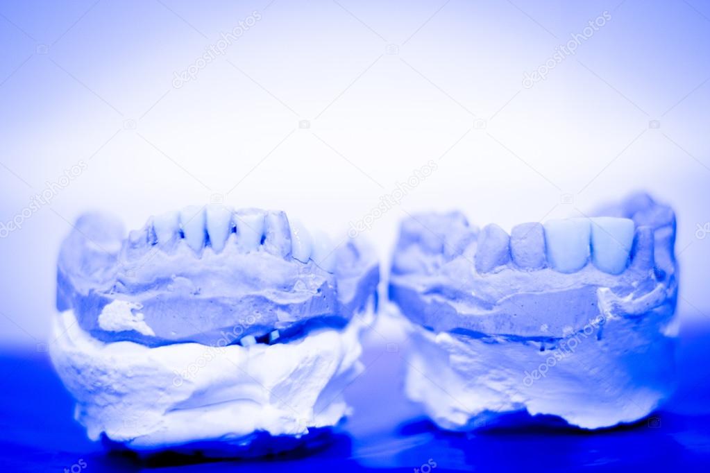 Dental prosthetics clay tooth mold — Stock Photo © edwardolive #95430630