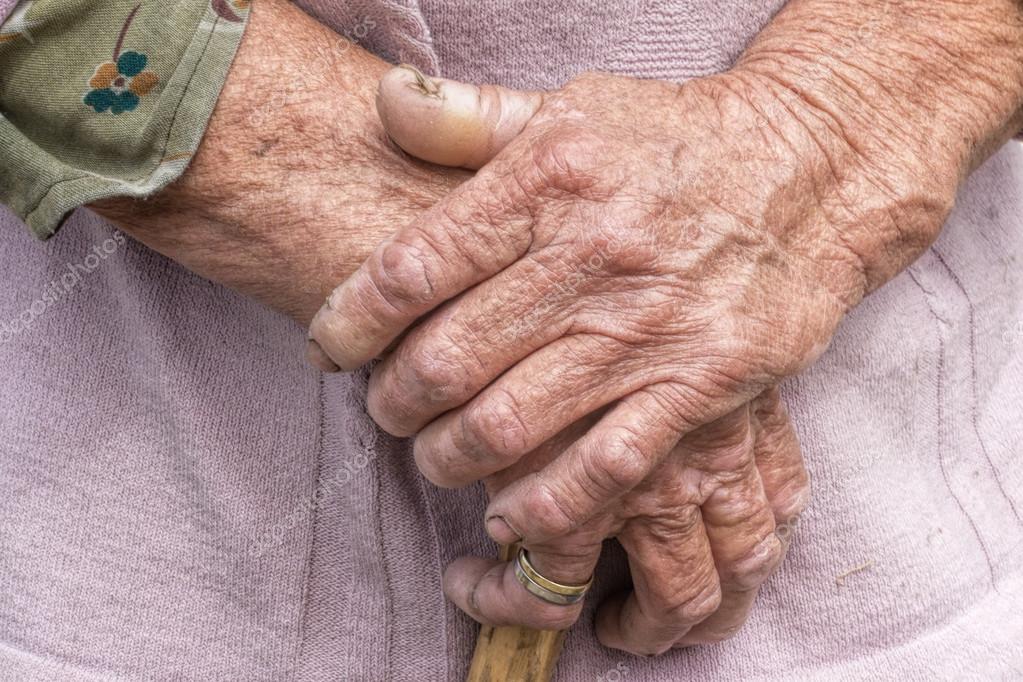 Aging process - very old senior woman hands wrinkled skin Stock Photo ...