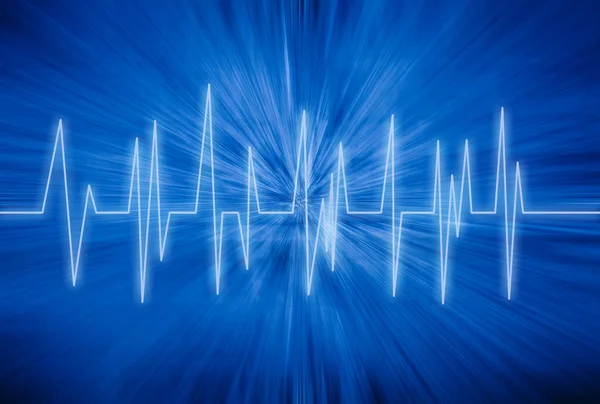 Diagramme du rythme cardiaque images libres de droit, photos de ...